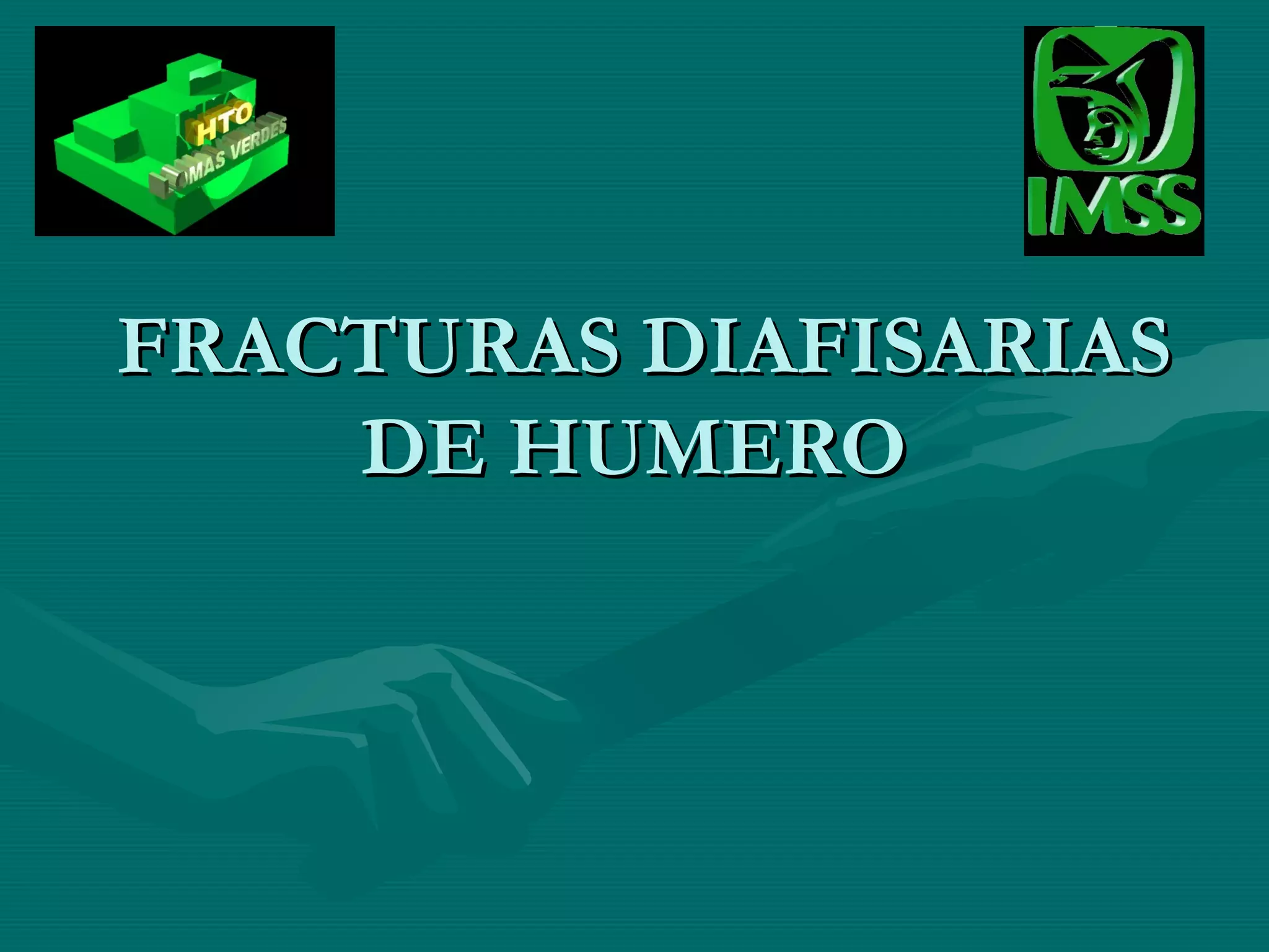 Fracturas diafisarias de humero | PPT