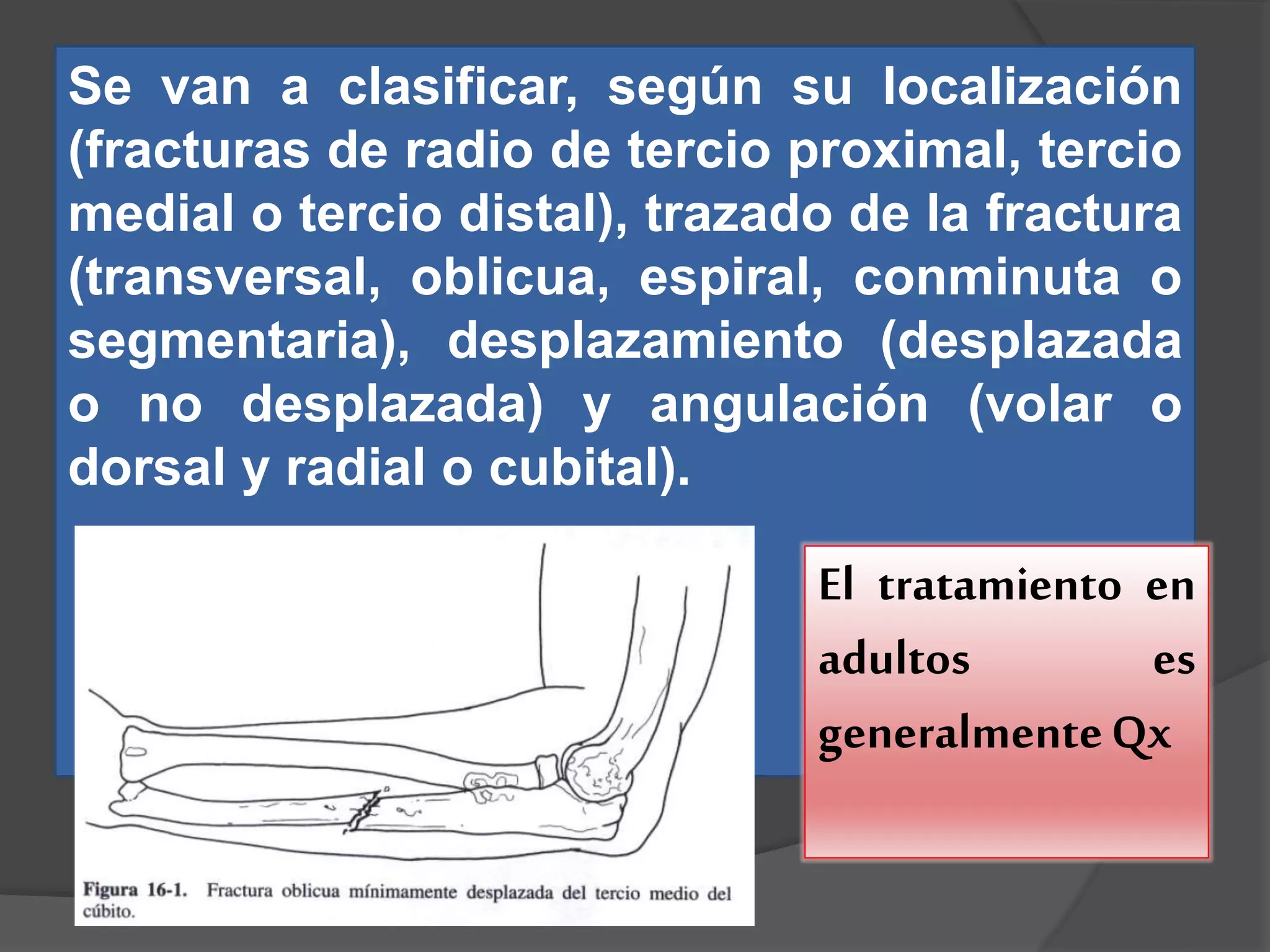 Fracturas Diafisarias de Cubito y Radio. | PPTX