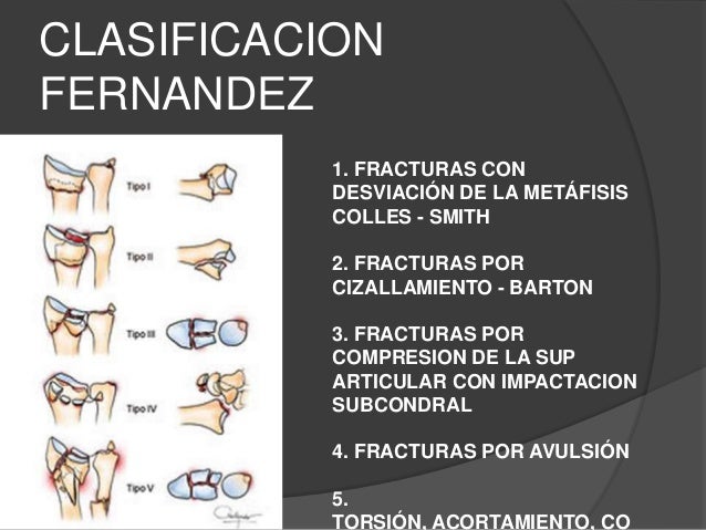 Fracturas diafisiarias y tercio distal de radio y cubito