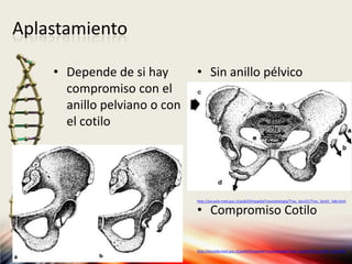 Fracturas en miembros inferior | PPTX