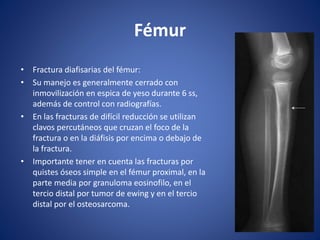 Fracturas en niños | PPTX