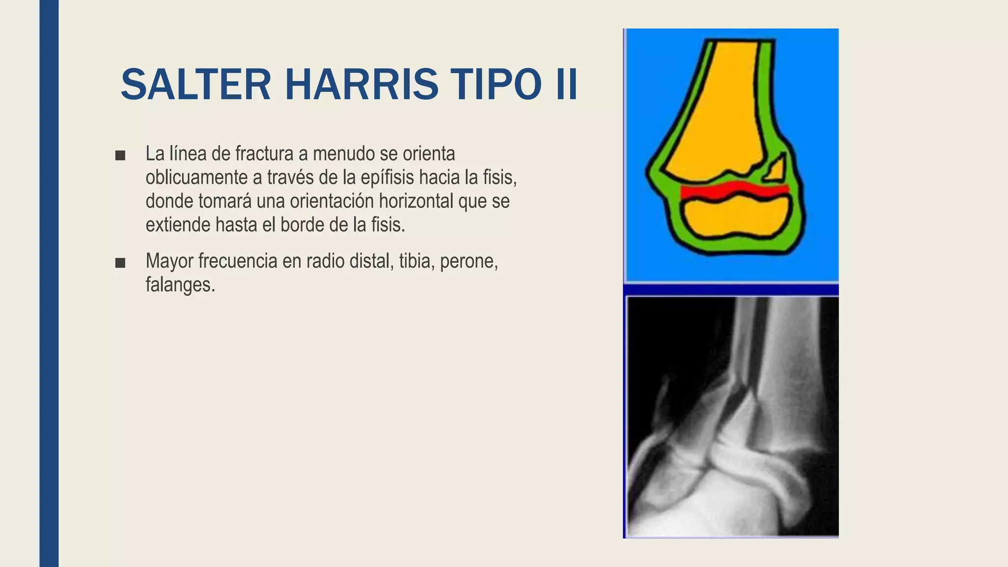 Fracturas en pediatría.pptx
