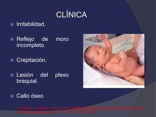 Fracturas en recien nacidos 2016 | PPTX