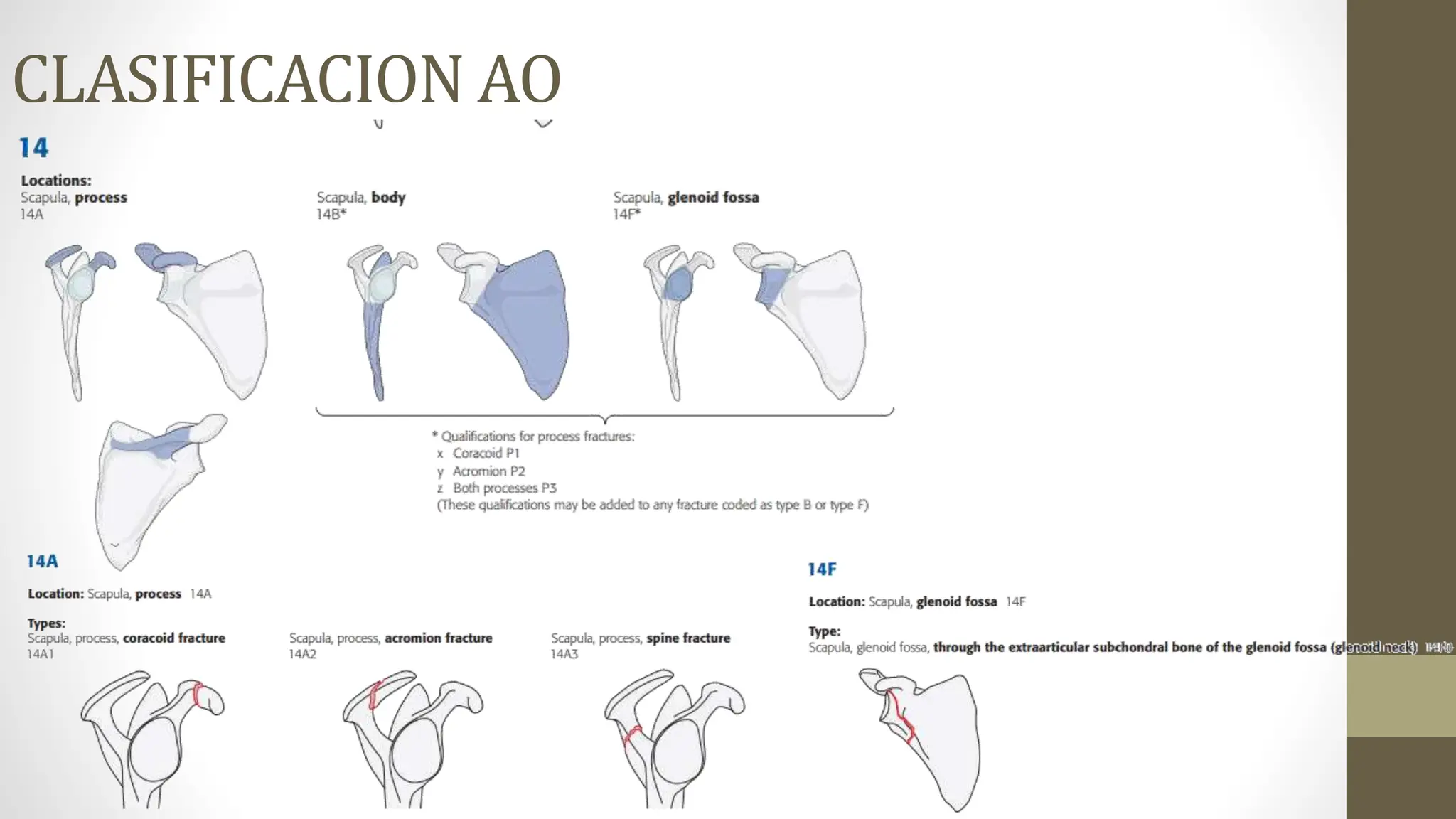 ANATOMIA Y FRACTURAS DE ESCAPULA Y ACROMION.pptx