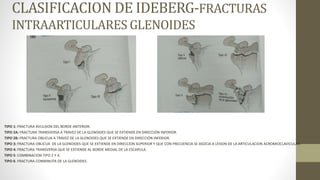 ANATOMIA Y FRACTURAS DE ESCAPULA Y ACROMION.pptx