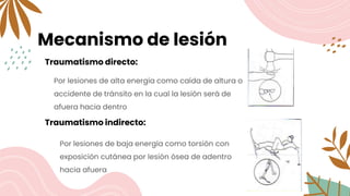 Fracturas expuestas exposición traumatología y ortopedia | PPTX