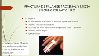 Fracturas falanges | PPTX