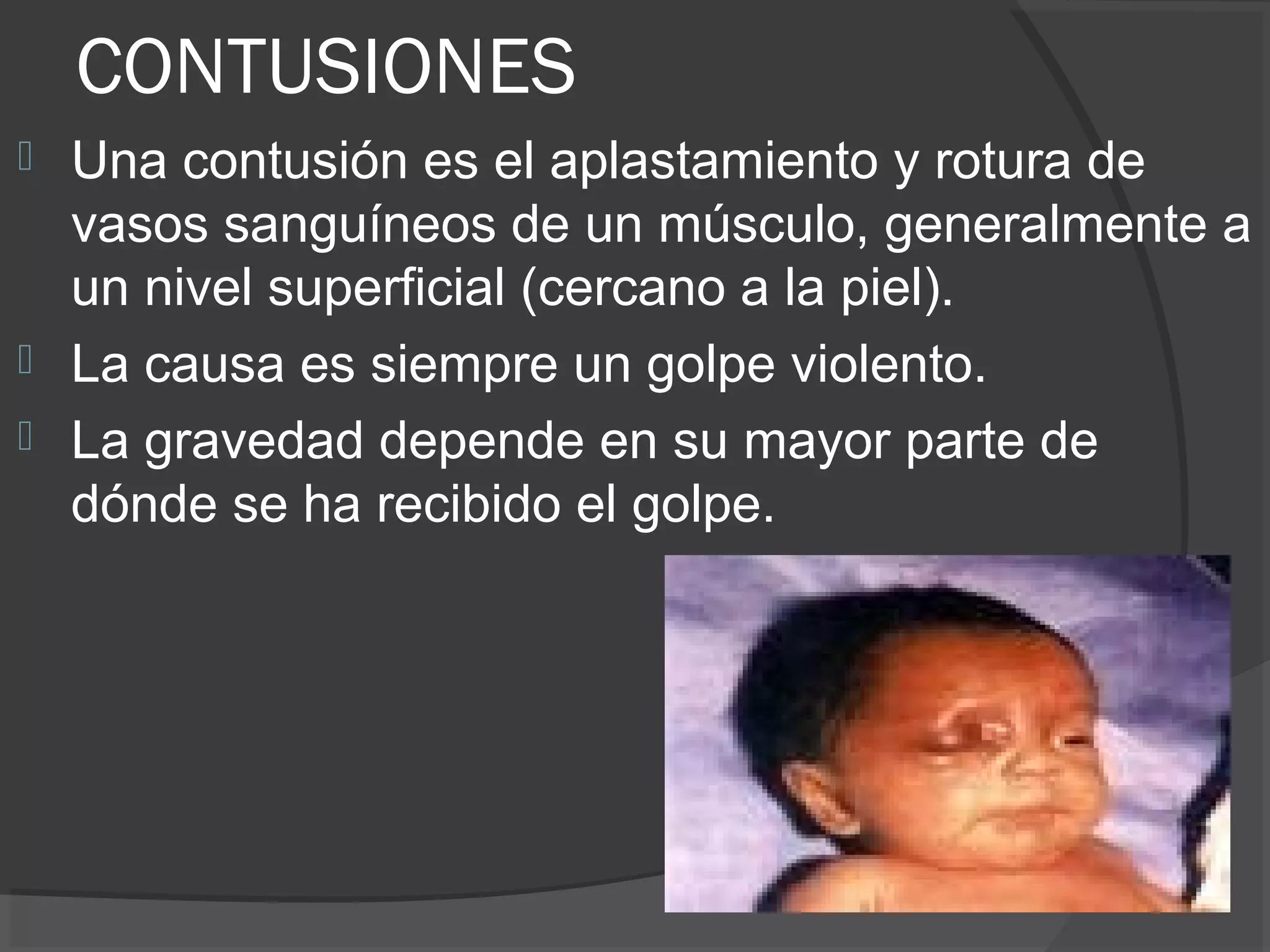 Fracturas , heridas, contusiones, escoriaciones, | PPT