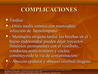 Fracturas hueso temporal | PPT