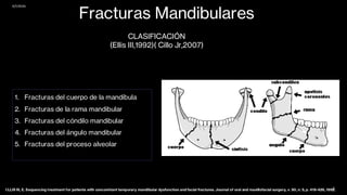 Fracturas Mandibulares y tecnicas de fijacion .pdf