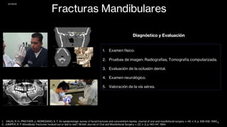 Fracturas Mandibulares y tecnicas de fijacion .pdf