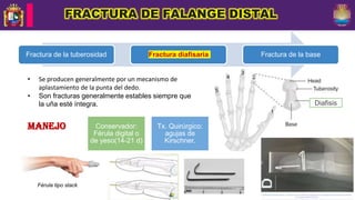 Fractura de MTC y falanges de la mano | PPTX