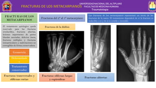 Fractura de MTC y falanges de la mano | PPTX
