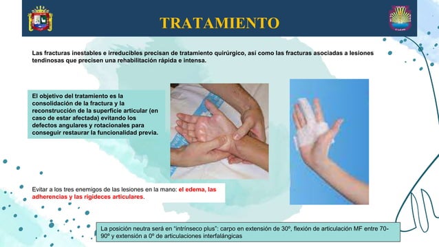 Fractura de MTC y falanges de la mano | PPT
