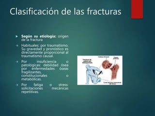 Tipos Fracturas ortopedia | PPT