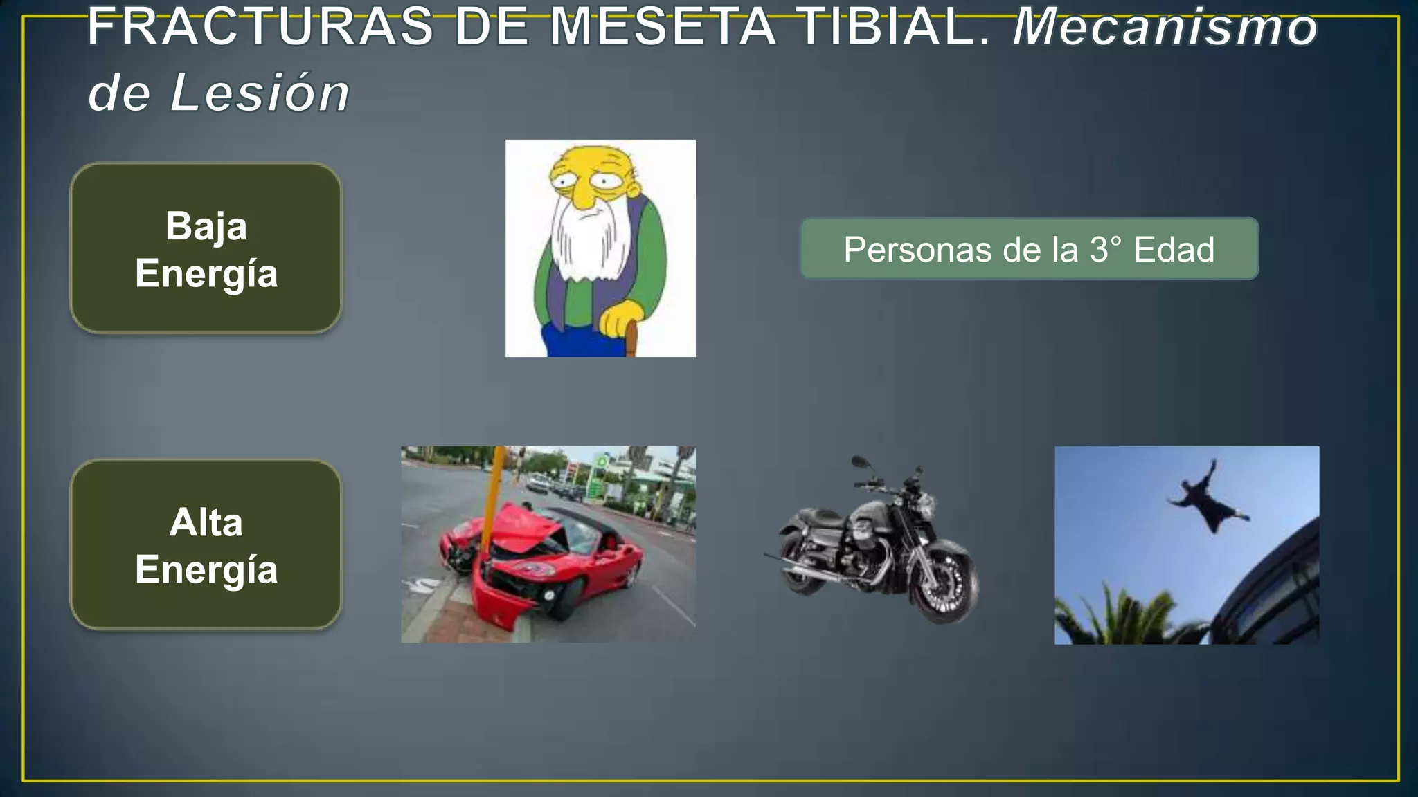 Fracturas proximales de tibia y perone | PPTX