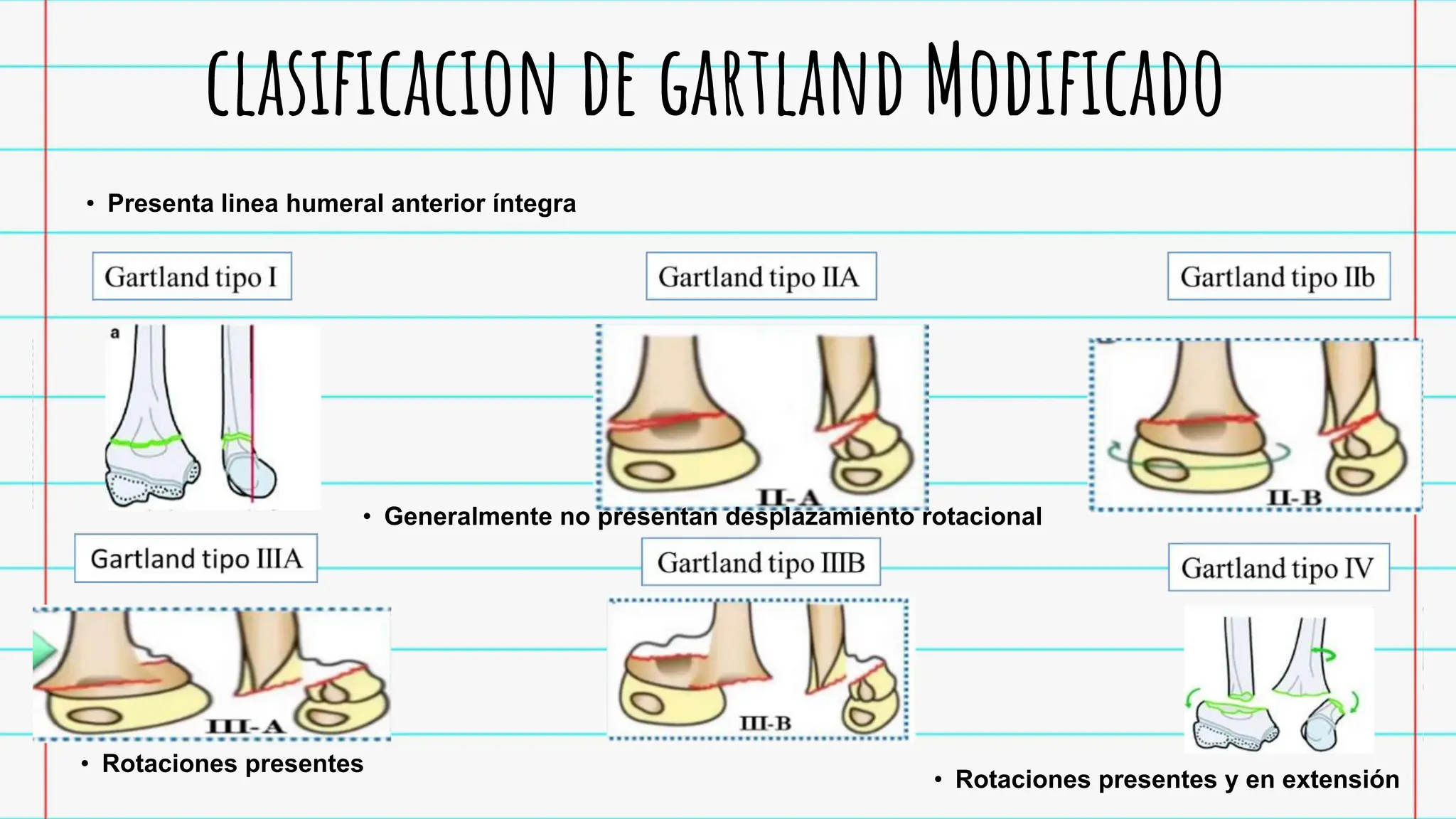 Fracturas supracondilias en el humero distal en niños.pptx