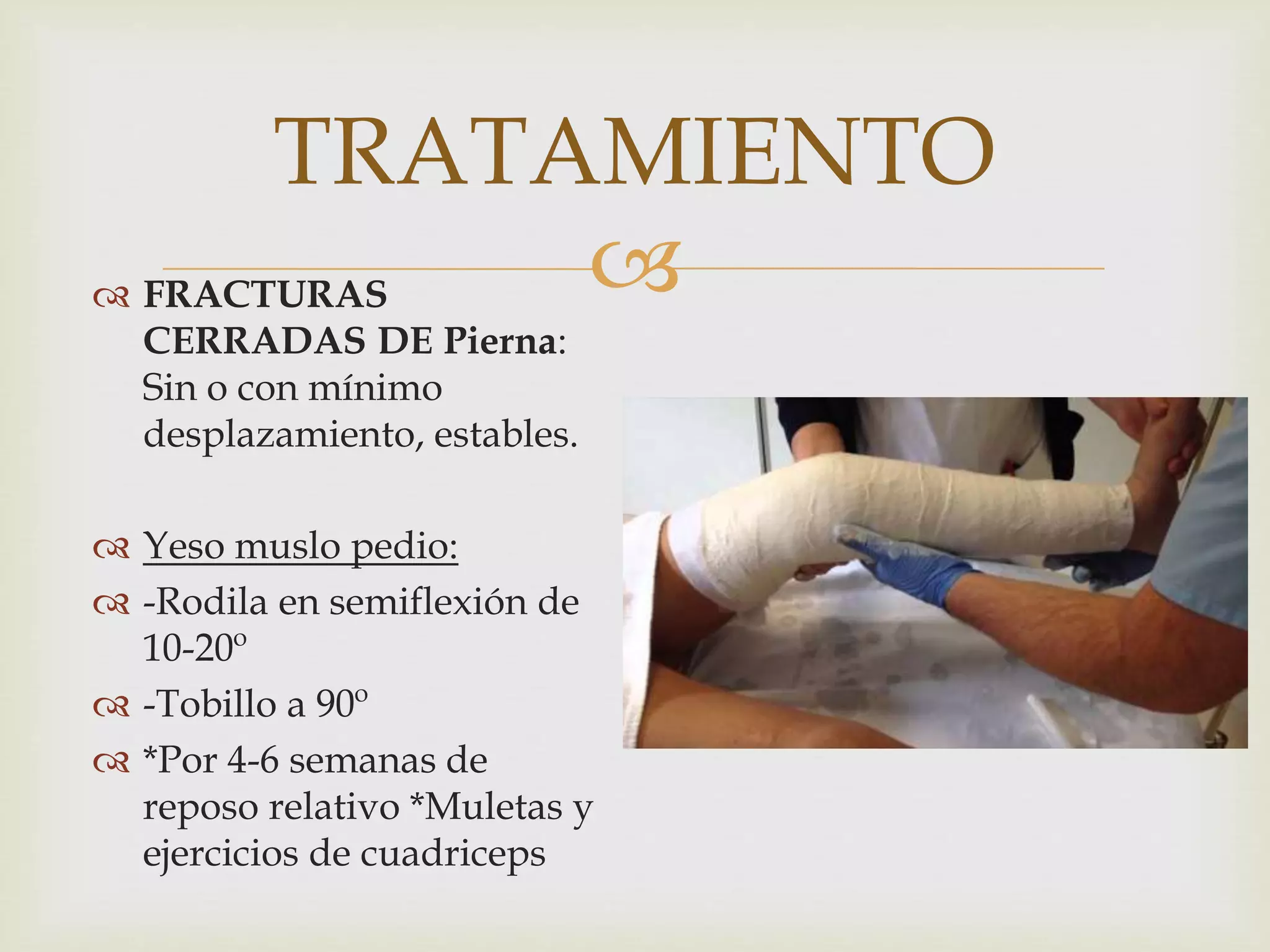 Fracturas de Tibia y peroné | PPTX