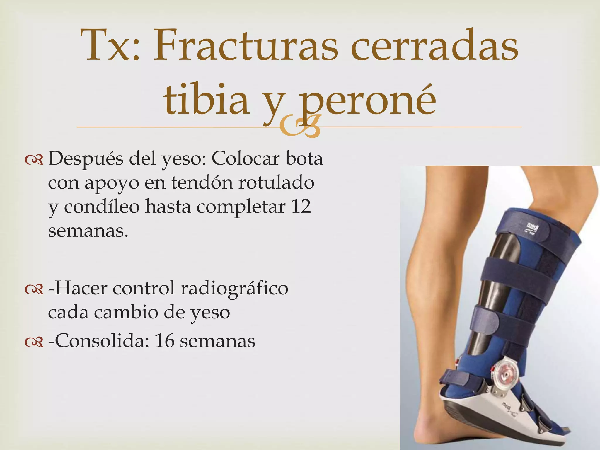 Fracturas de Tibia y peroné | PPT