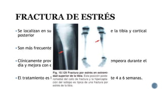 Fracturas de tibia y tobillo en niños | PPTX