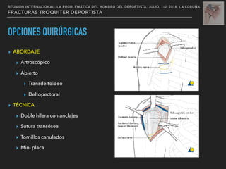 Fracturas troquiter hombro deportista | PDF