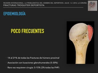 Fracturas troquiter hombro deportista | PDF