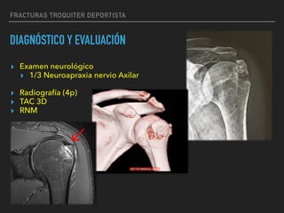 Fracturas troquiter hombro deportista | PDF
