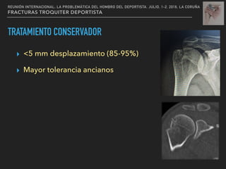 Fracturas troquiter hombro deportista | PDF