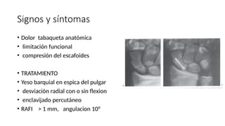 fracturas y luxaciones de carpo.ppt traumatologiax | PPTX