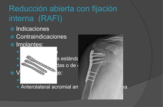 Fracturas y luxaciones de hombro | PPTX