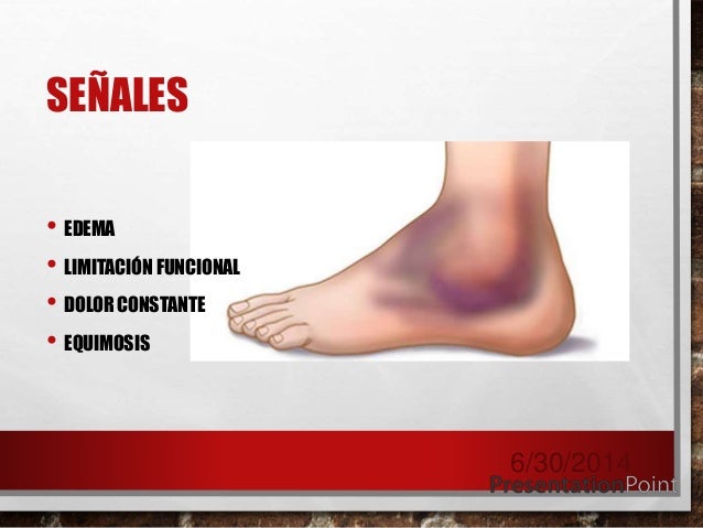 Fracturas y torceduras