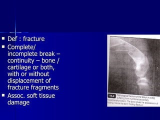 Types of fractures | PPT