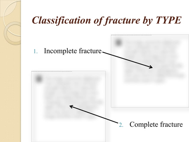 Fracture | PPT