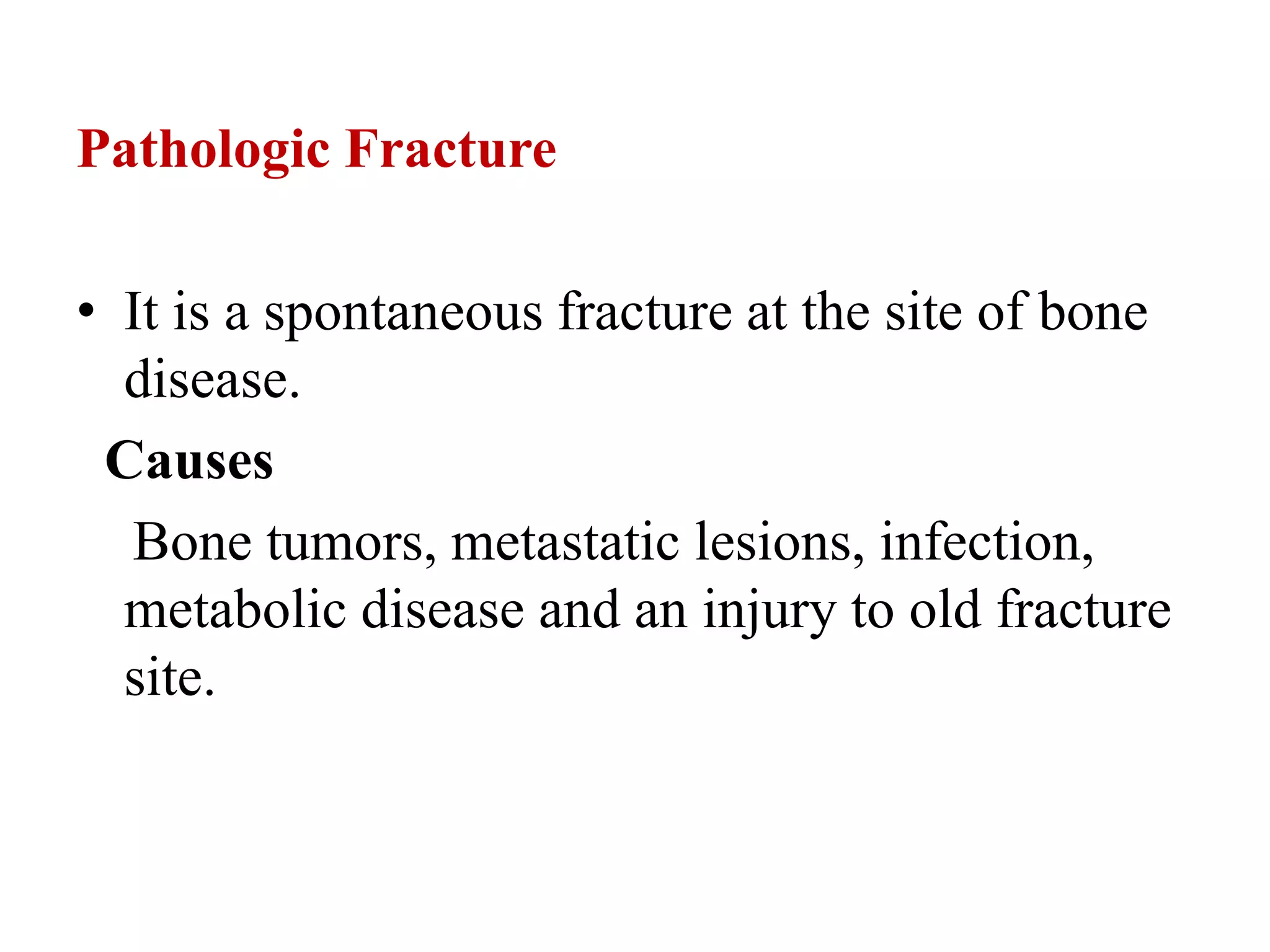 Fracture | PPTX
