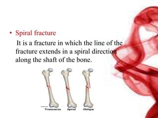 Fracture | PPTX