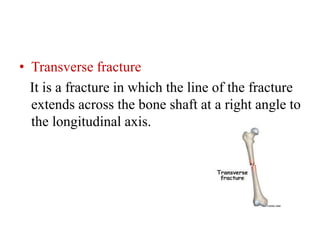 Fracture | PPTX