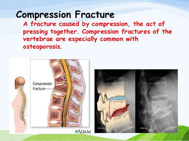 Fracture and its nursing management