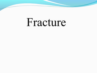 Fracture | PPT | Physics | Science