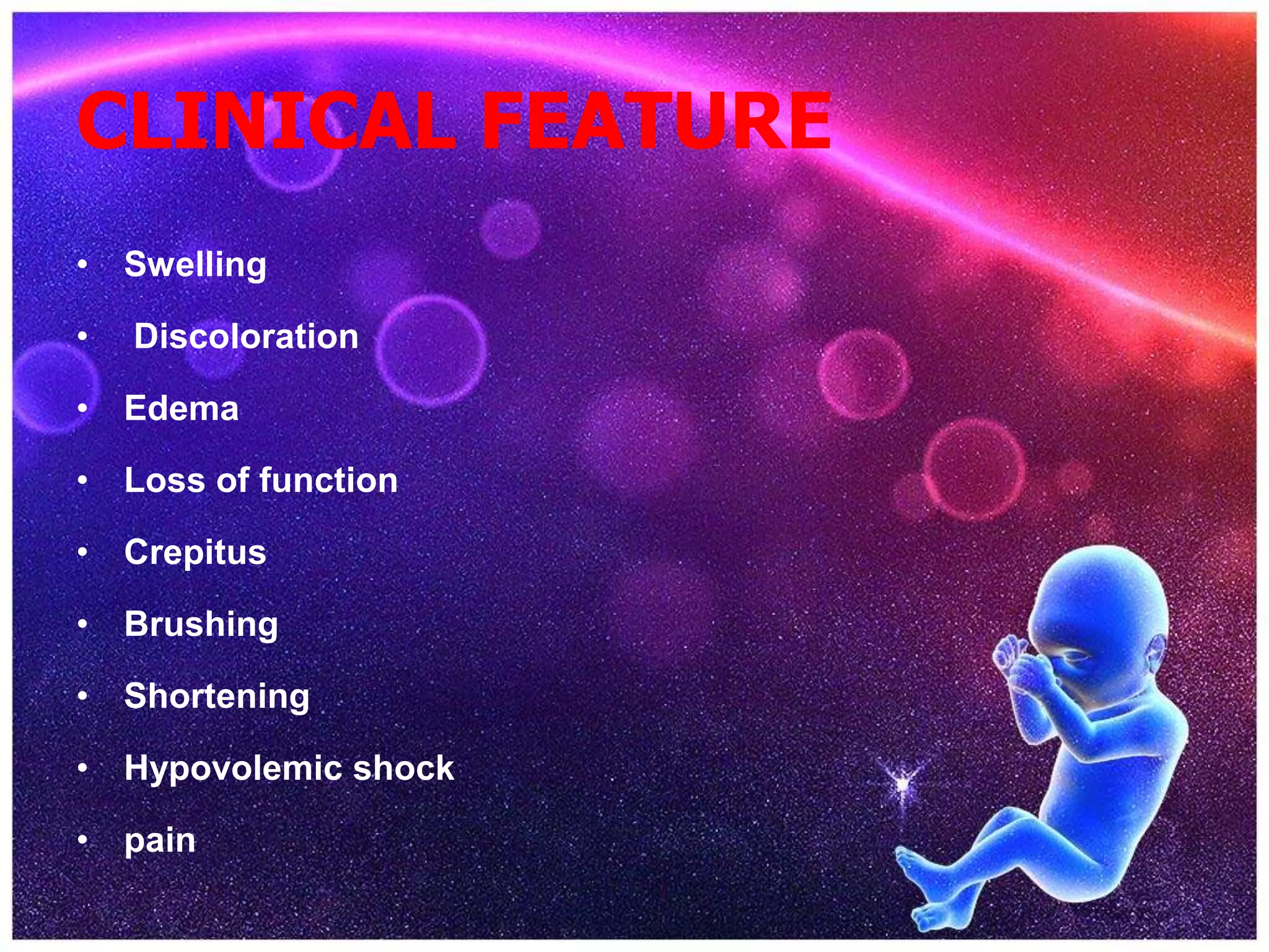 Fracture and nursing management | PPTX