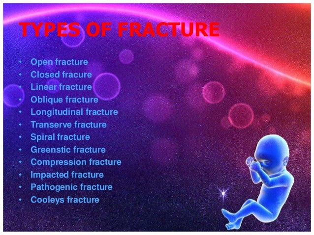 Open vs closed fracture - rillymetro