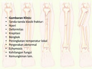 Fracture | PPT