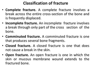 Fracture | PPT
