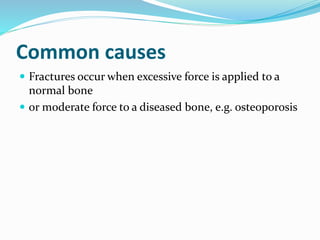 Fracture (Kasar) | PPT