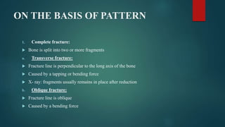 Fracture | PPT