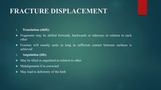 Fracture | PPT