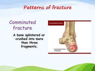 Fracture and it's Nursing Management | PPTX