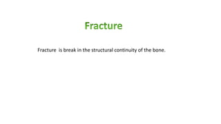 Fracture | PPT