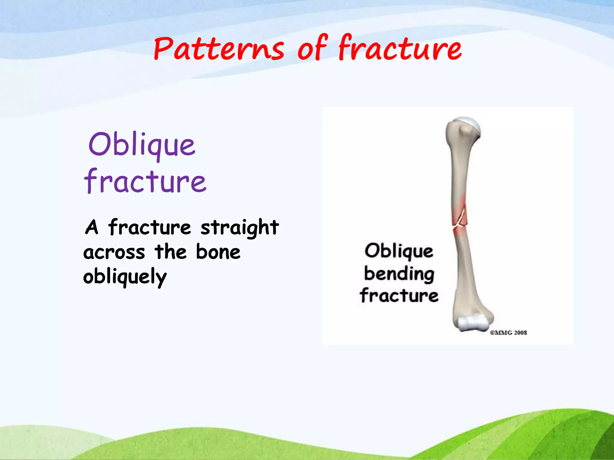FRACTURE (TYPES AND PATTERN) | PPTX
