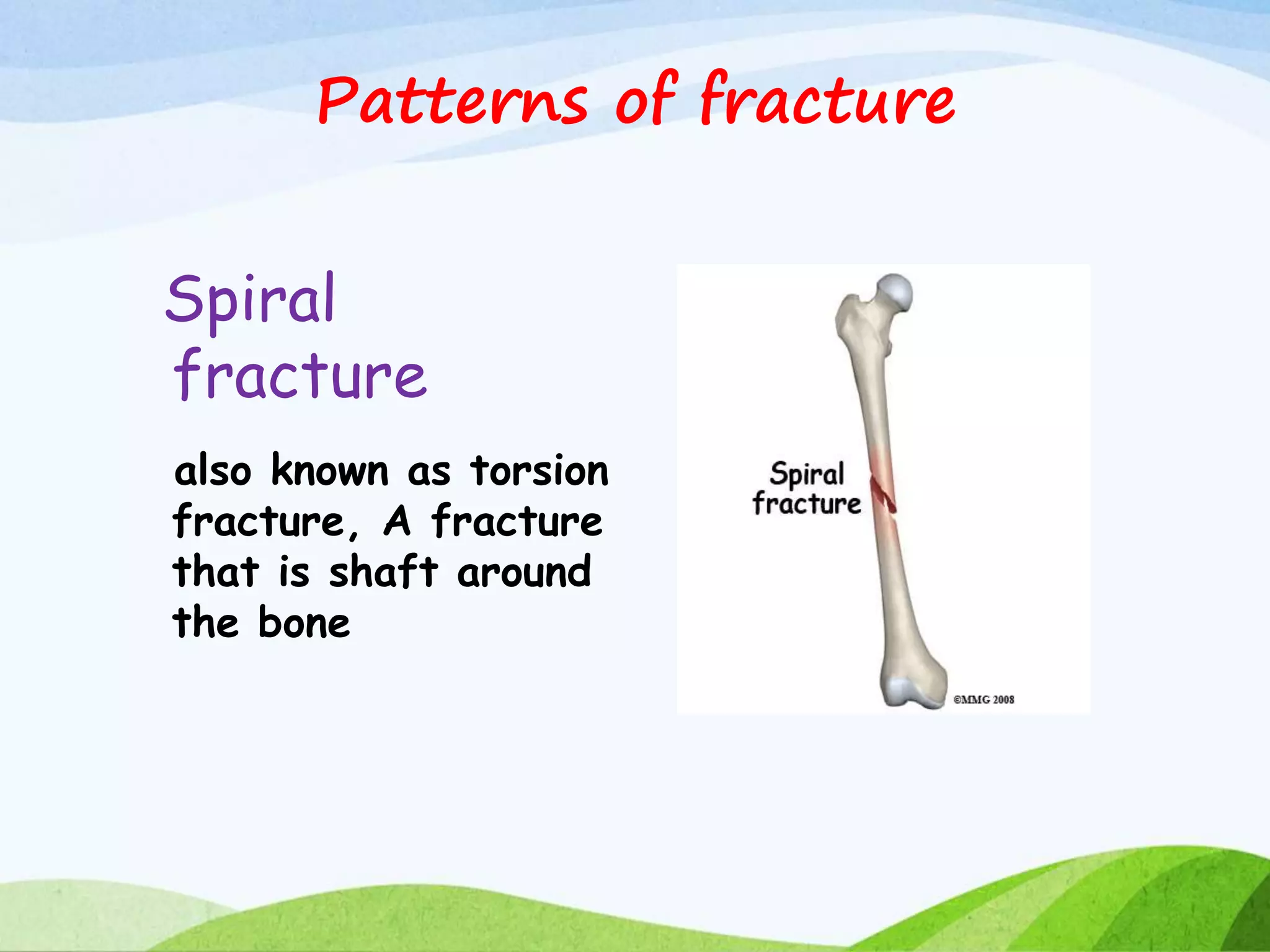 FRACTURE (TYPES AND PATTERN) | PPTX