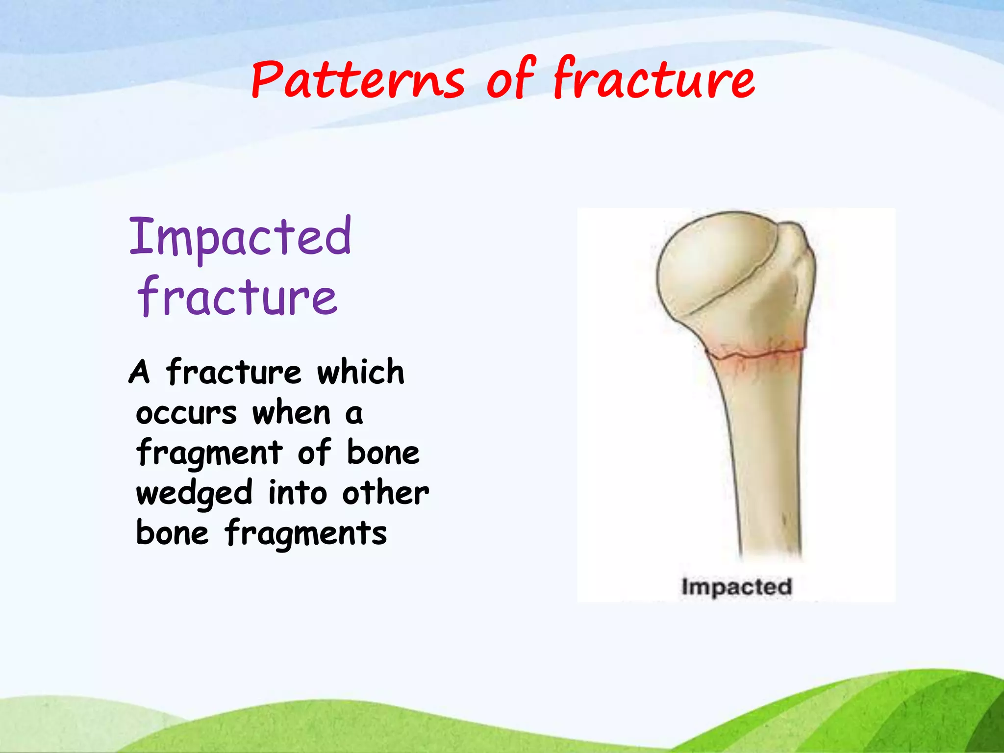FRACTURE (TYPES AND PATTERN) | PPTX